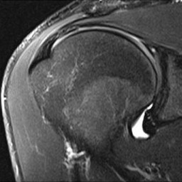 Arthroscanner - IMPC Paris - diagnostic des douleurs articulaires