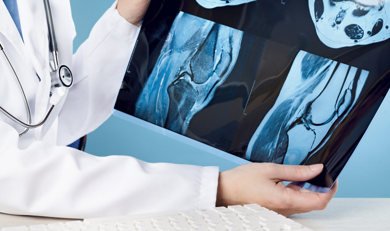 IRM genou - IMPC Paris- diagnostics des douleurs du genou
